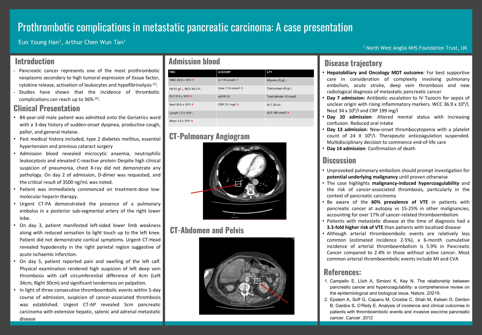 Prothrombotic complications in metastatic pancreatic carcinoma: A case ...